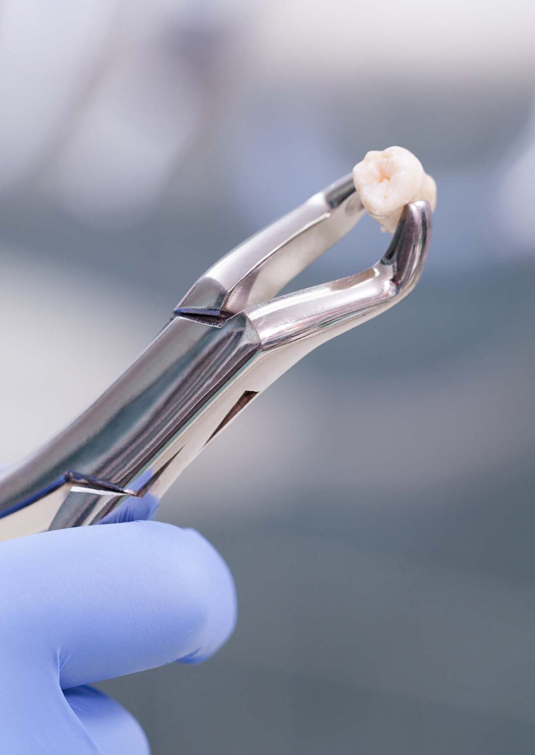 Trekken tand of kies – Tandzorg Buiksloot